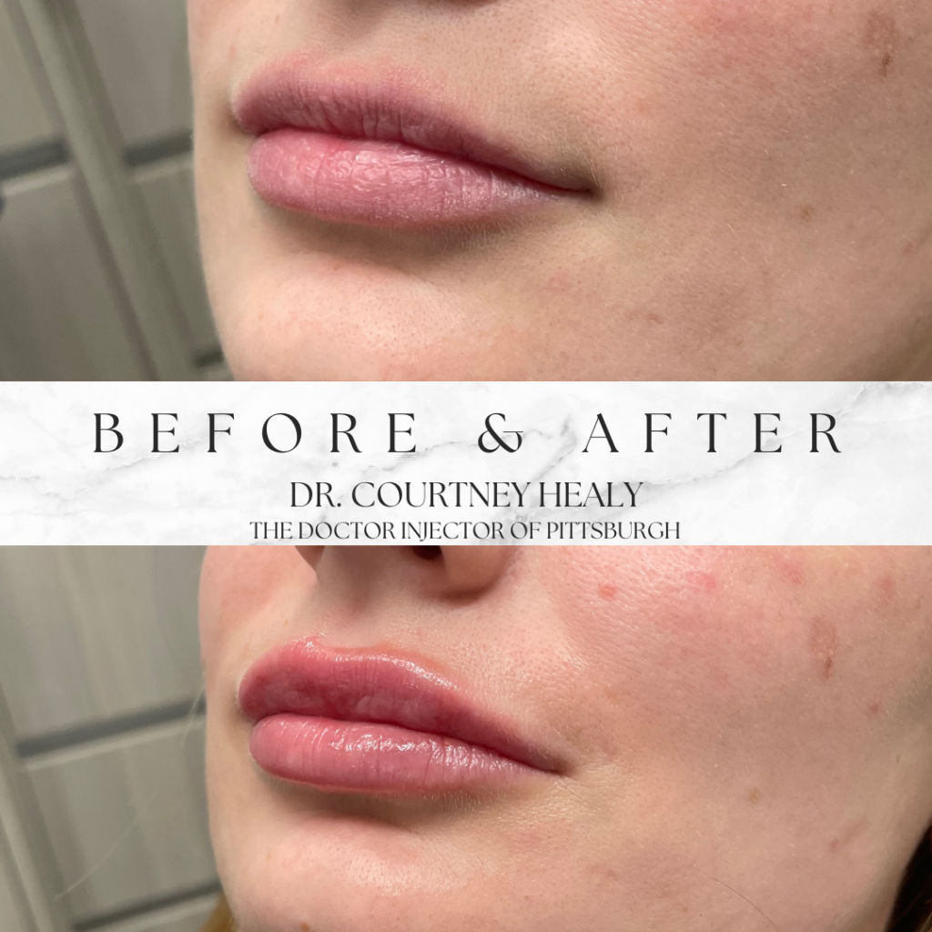 The Doctor Injector of Pittsburgh - Pittsburgh Aesthetics