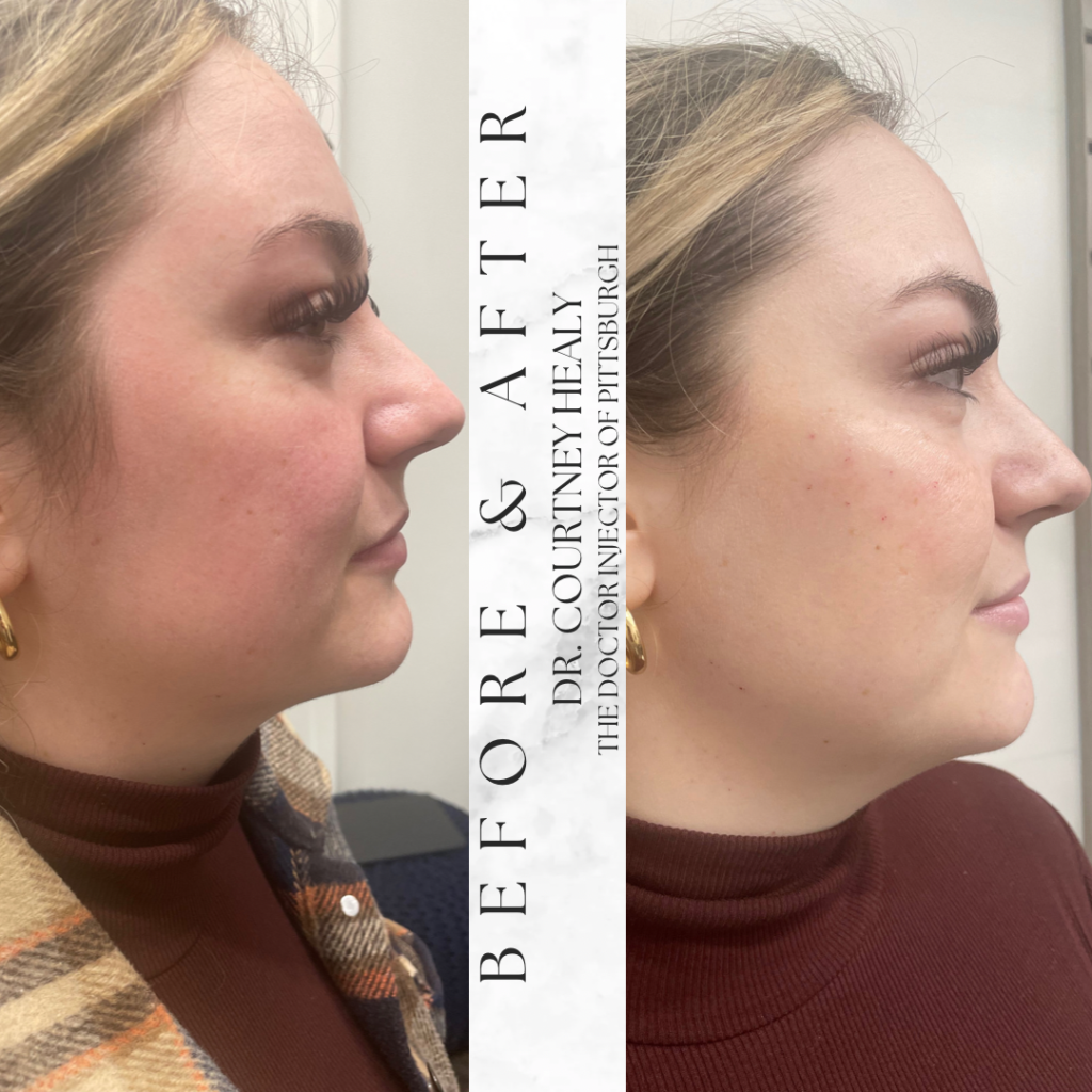 The Doctor Injector of Pittsburgh - Pittsburgh Aesthetics