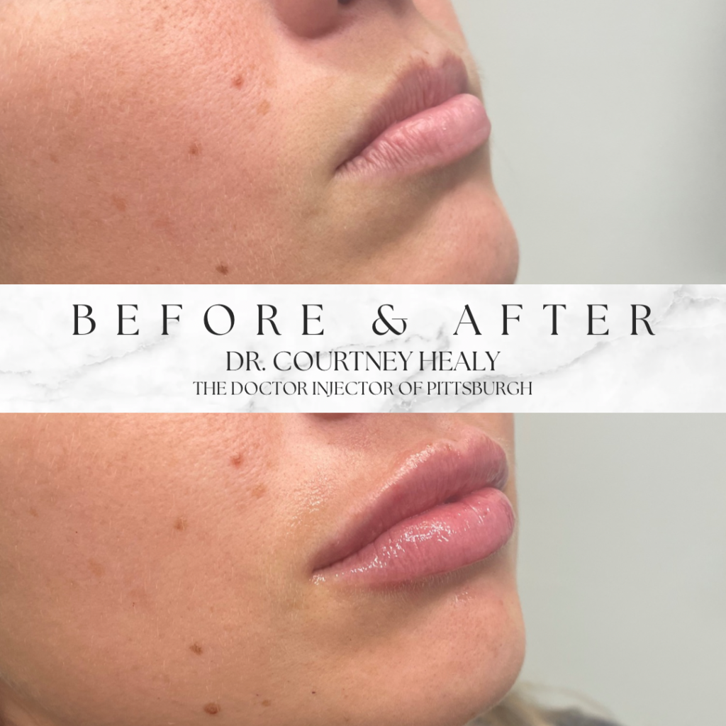 The Doctor Injector of Pittsburgh - Pittsburgh Aesthetics