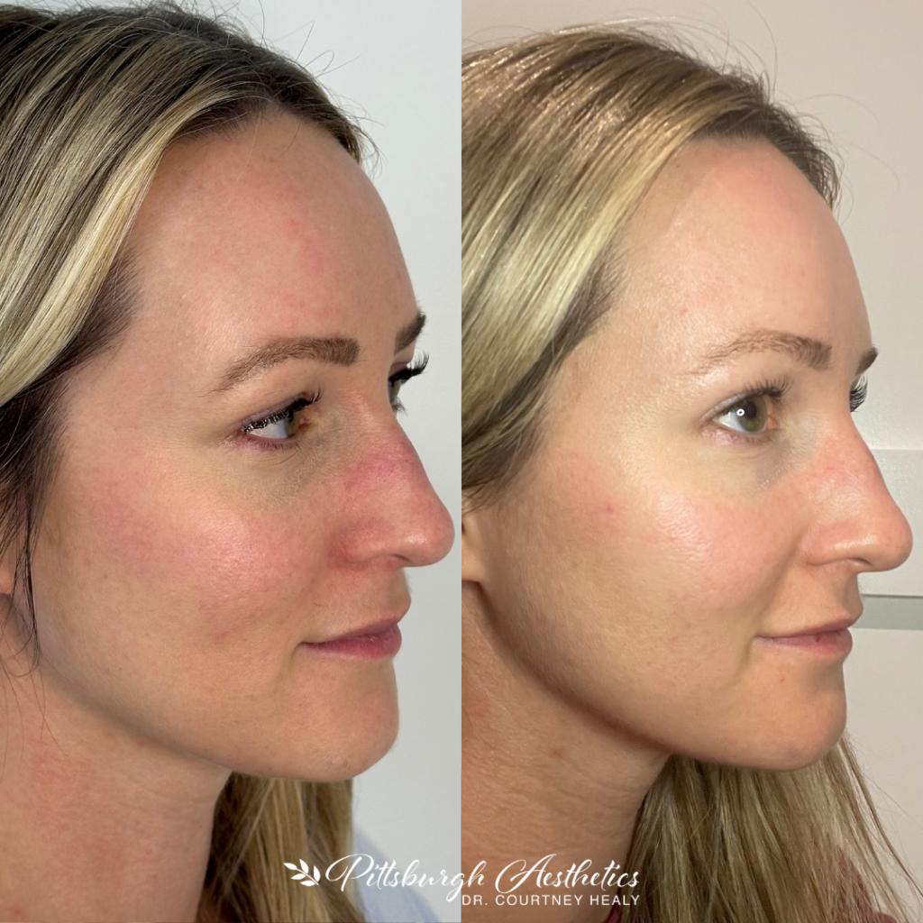 Med Spa Pittsburgh, PA | Botox, Fillers & Skincare