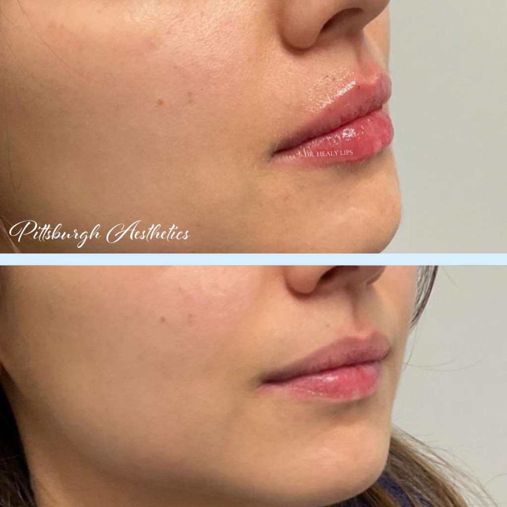 Med Spa Pittsburgh, PA | Botox, Fillers & Skincare